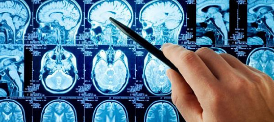 Russian Scientists Learn to Diagnose Depression via MRI